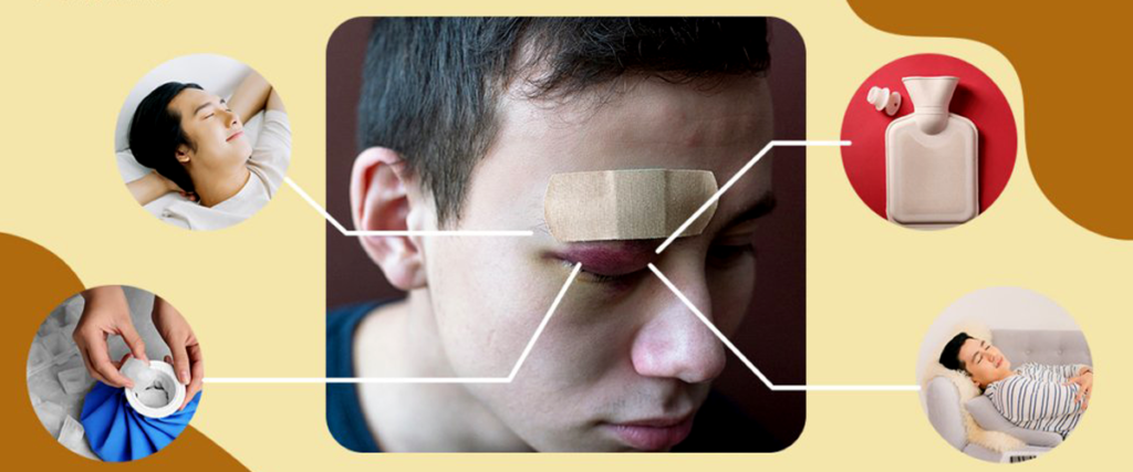 Black Eye Treatment | Fast Recovery Tips | Shinagawa Lasik